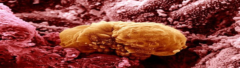 Apposition :: Implantation